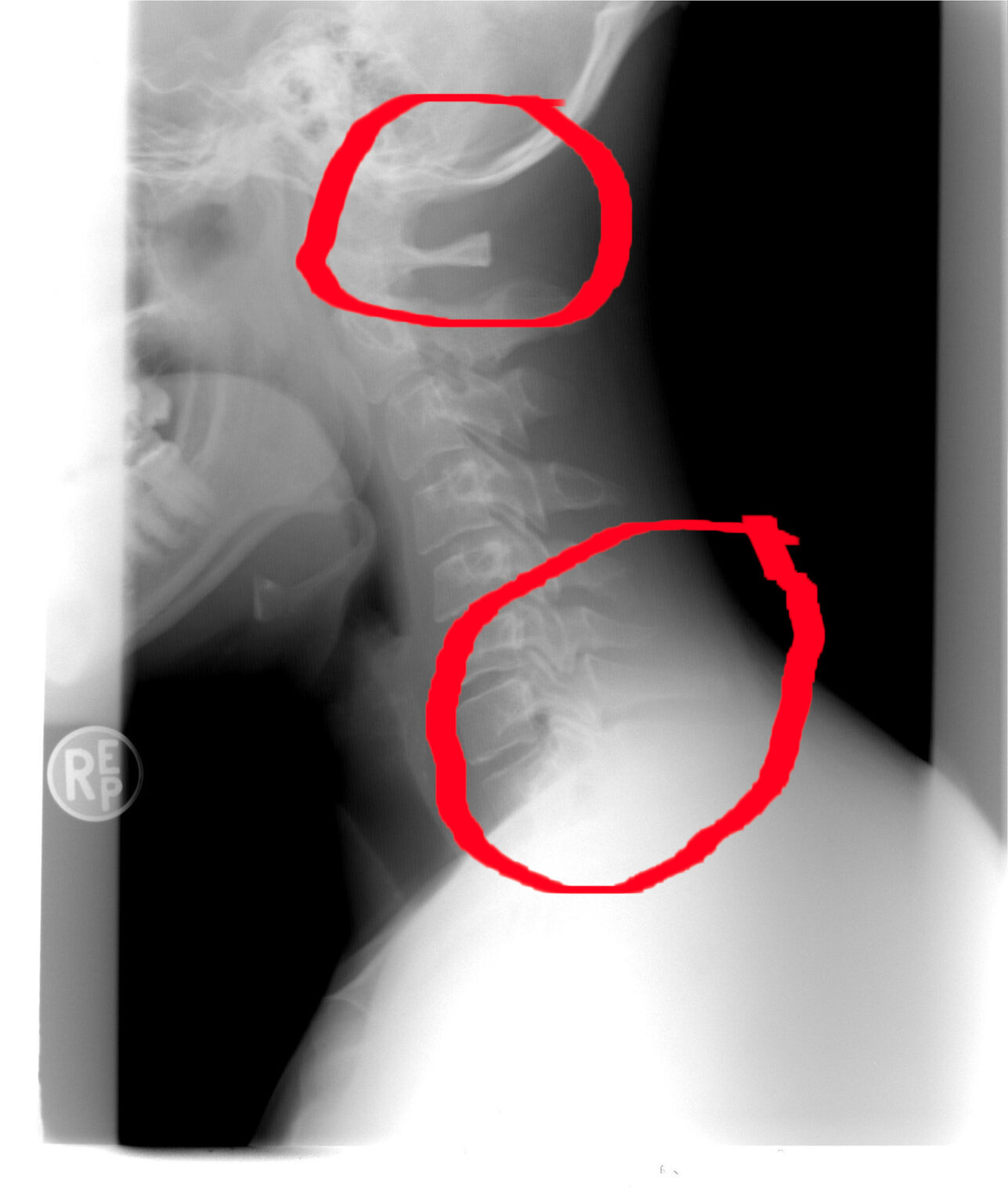 Spiritual Meaning Of Spine: 5 Vibrational Lenses That Shape Us ...